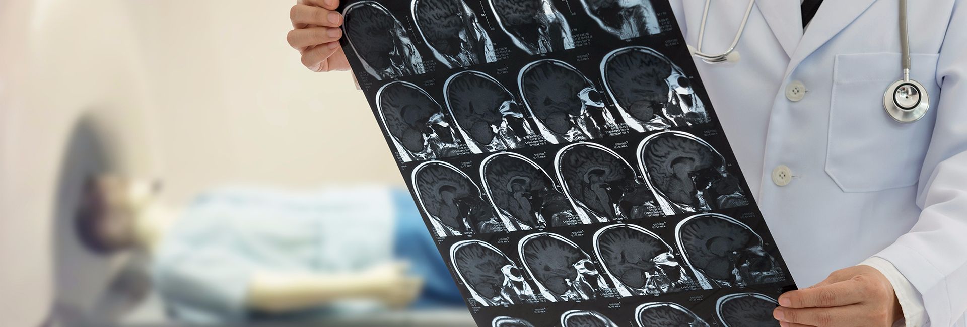 Νευρολόγος Κέρκυρα | Νικόλαος Δημησιάνος